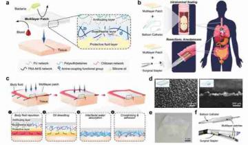 《Advanced Materials》:一种用于微创组织缝合的多功能贴片